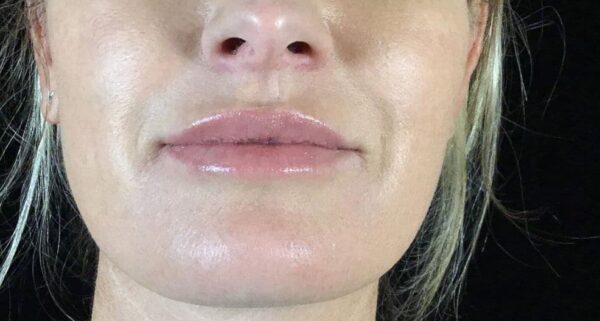 Dr. Monica Scheel Dermatology - Kona, Waimea, Hawaii, Big Island