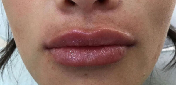 Dr. Monica Scheel Dermatology - Kona, Waimea, Hawaii, Big Island