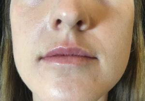 Dr. Monica Scheel Dermatology - Kona, Waimea, Hawaii, Big Island