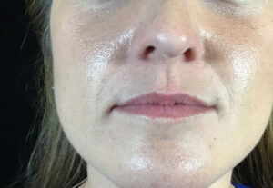 Dr. Monica Scheel Dermatology - Kona, Waimea, Hawaii, Big Island