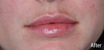 Dr. Monica Scheel Dermatology - Kona, Waimea, Hawaii, Big Island