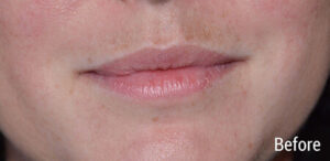 Dr. Monica Scheel Dermatology - Kona, Waimea, Hawaii, Big Island