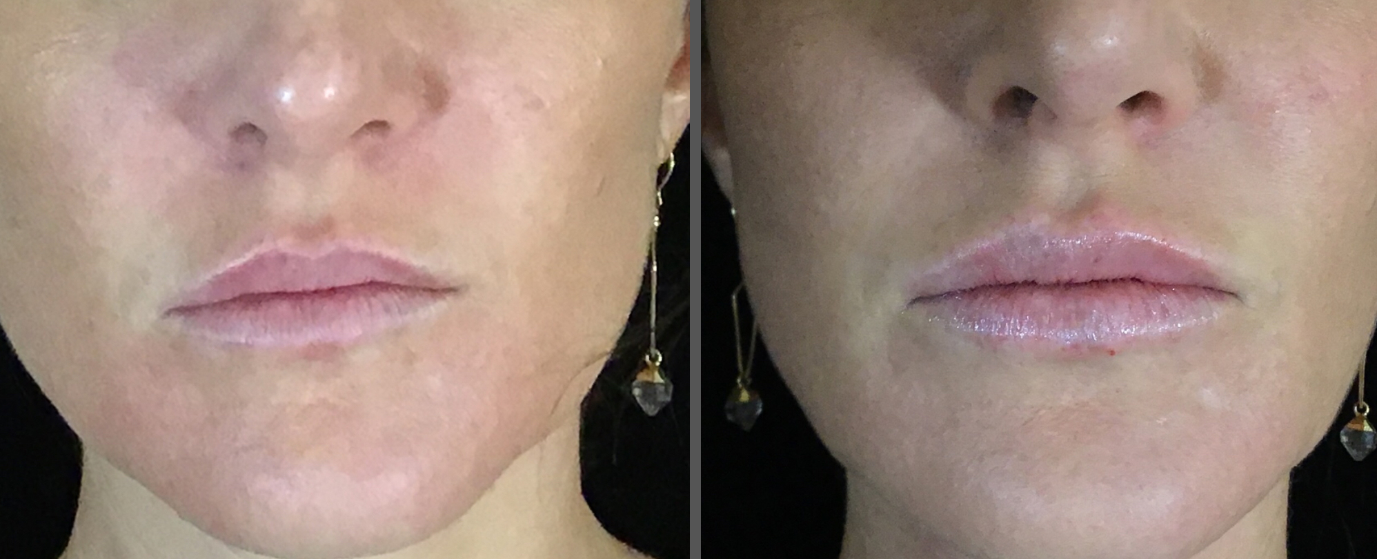 Staying On The Cutting Edge | Dr Monica Scheel Dermatology, Kailua-Kona, HI